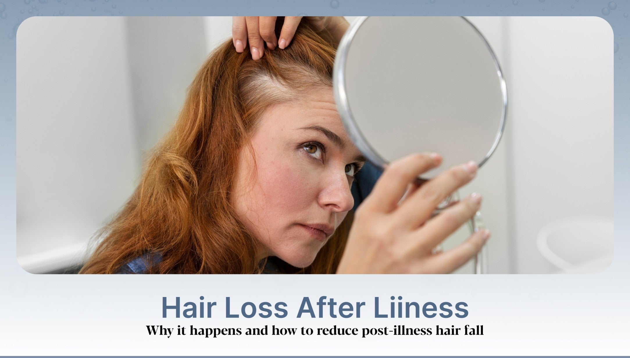 Hair Loss After Illness: Causes, Treatment & Prevention Tips