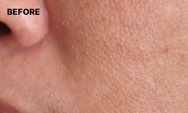 Gentle Exfoliating Face Scrub for Clear & Glowing Skin | Chemist At ...